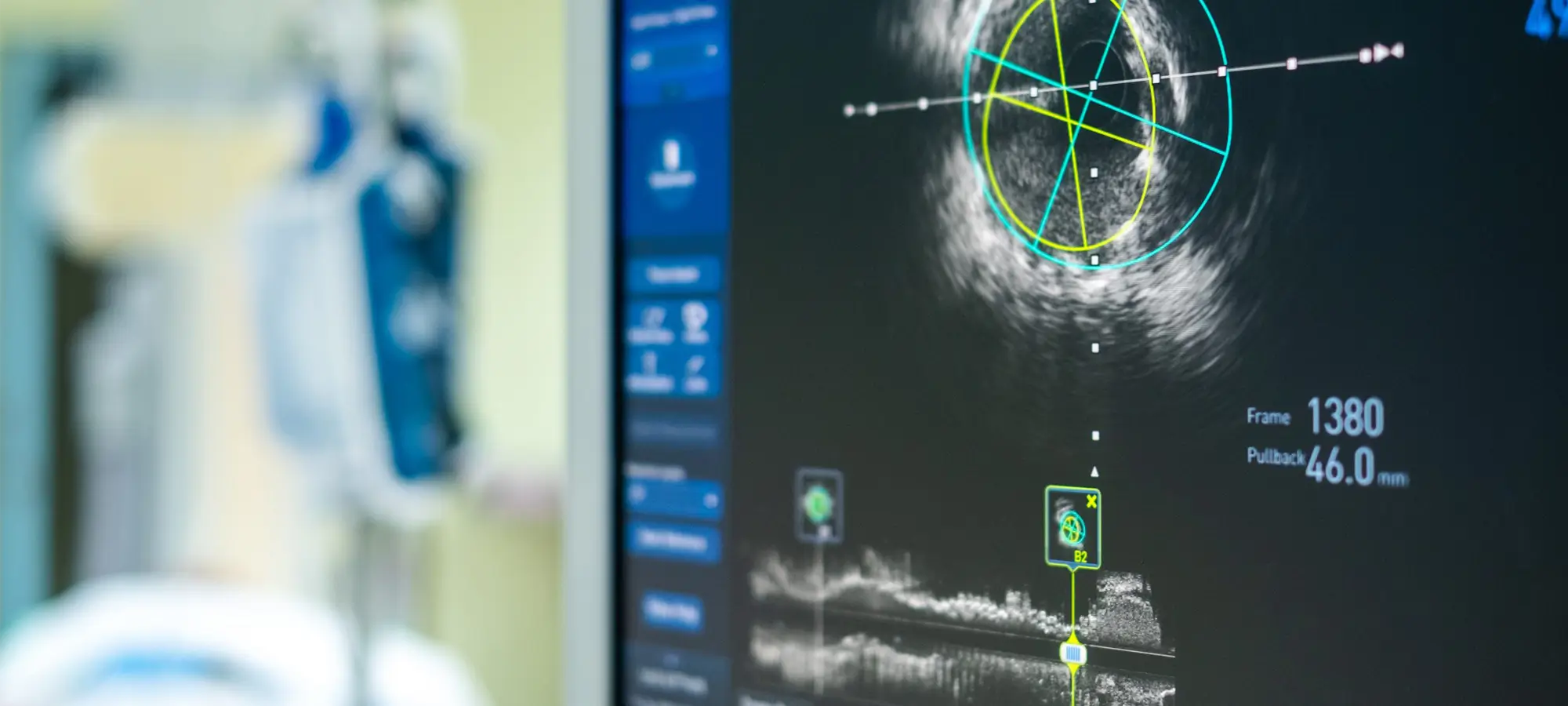 Cardiac Catheterization Laboratory Services with United Regional ...